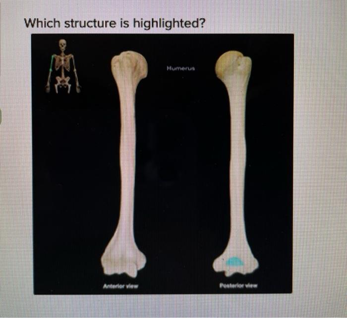 Solved Which structure is highlighted? Muroru Anterior view | Chegg.com