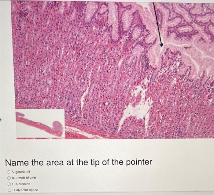 Solved Name the area at the tip of the pointer A. gastric | Chegg.com