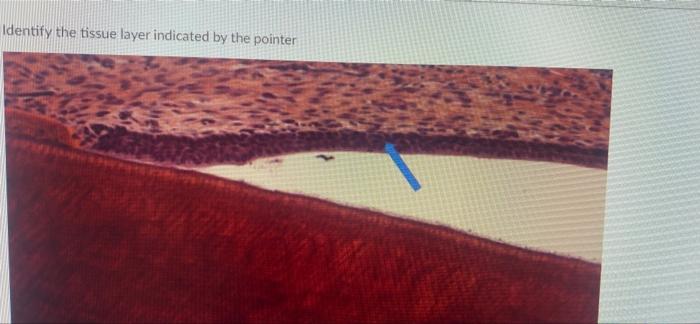 Solved Identify the tissue layer indicated by the pointer | Chegg.com