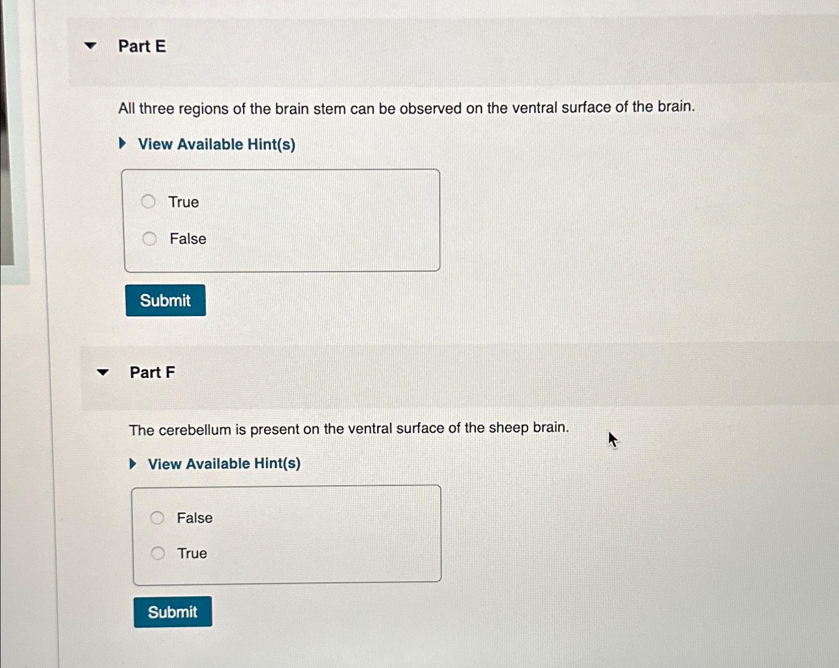 Solved Part EAll three regions of the brain stem can be | Chegg.com