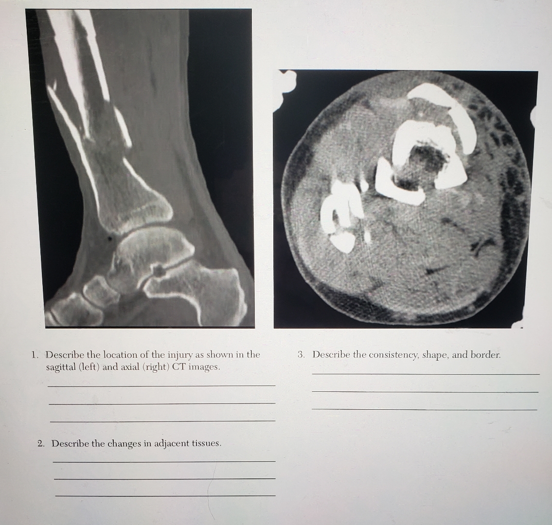 Solved Describe the location of the injury as shown in | Chegg.com