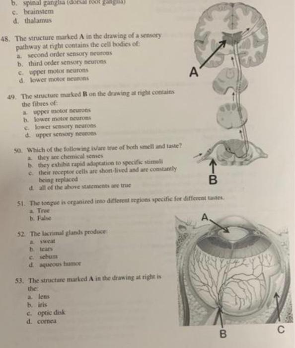 Solved b. spinal gangla (dorcal roor gangia) c. brainstem d. | Chegg.com