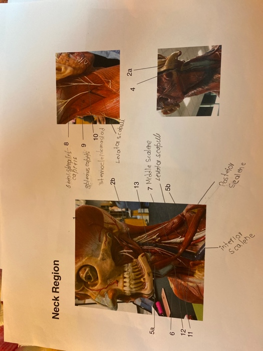 Solved Neck Region 6 em/ Shimales - 8 capris sblennus cabas | Chegg.com