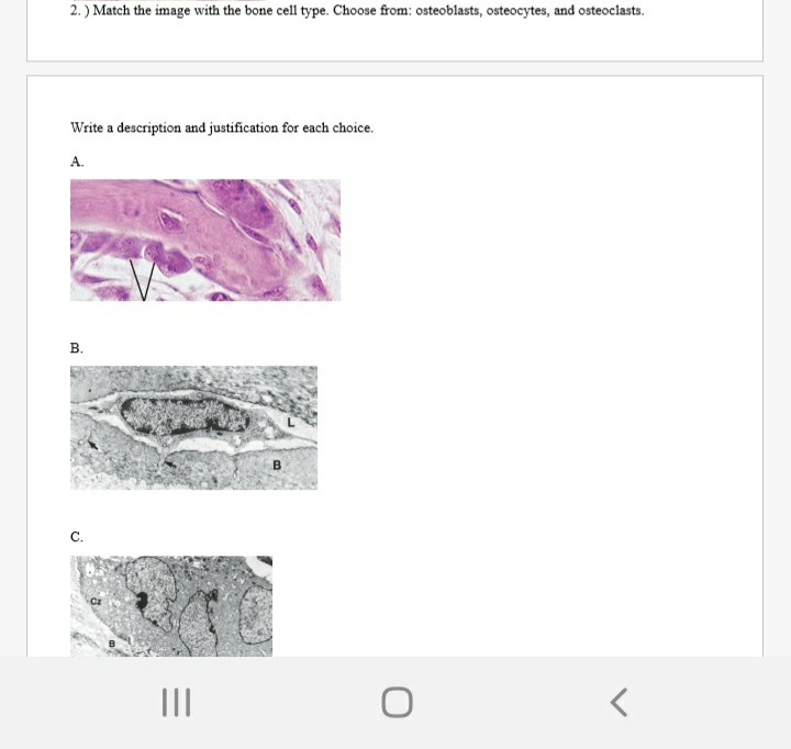 Solved 1 Identify the type of cartilage in each micrograph. | Chegg.com