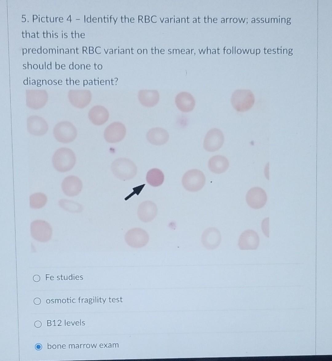 Solved 5. Picture 4 - Identify the RBC variant at the arrow; | Chegg.com