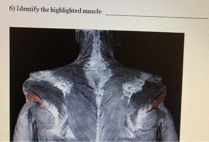 Solved 6) Identify the highlighted muscle. 7) Identify the | Chegg.com