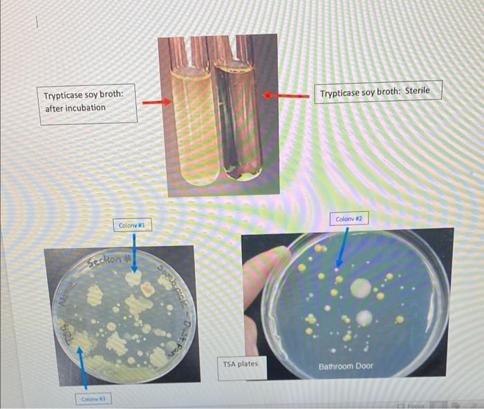 Solved 156 BIO 220 Microbiology 58 Case Study Exercise 6 | Chegg.com