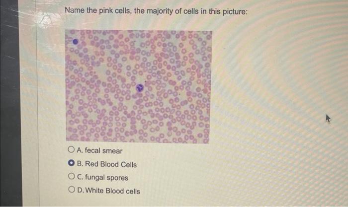 Solved Name the pink cells, the majority of cells in this | Chegg.com