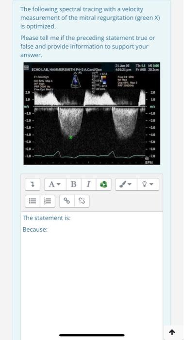 Solved The following spectral tracing with a velocity | Chegg.com