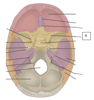 Solved Identify the bone labeled A in the figure. | Chegg.com