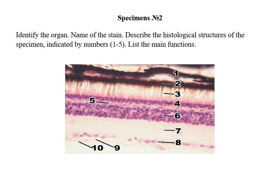 Solved Specimens No2 Identify the organ. Name of the stain. | Chegg.com