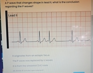 Solved A P wave that changes shape in lead II, ﻿what is the | Chegg.com