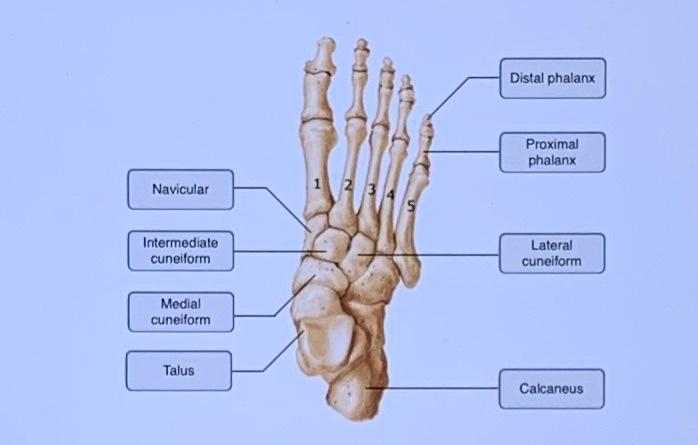 Solved Distal phalanx Proximal phalanx Navicular 234 | Chegg.com