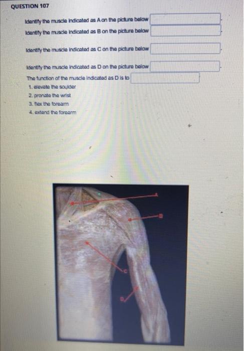 Solved QUESTION 107 Identify the muscle indicated as A on | Chegg.com