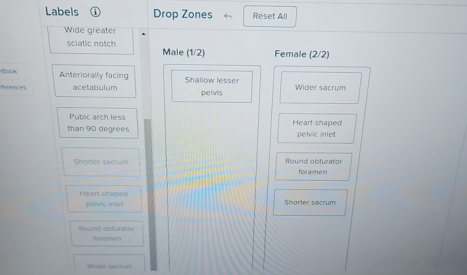Solved Labels(i)Drop ZonesAnteriorally facing | Chegg.com