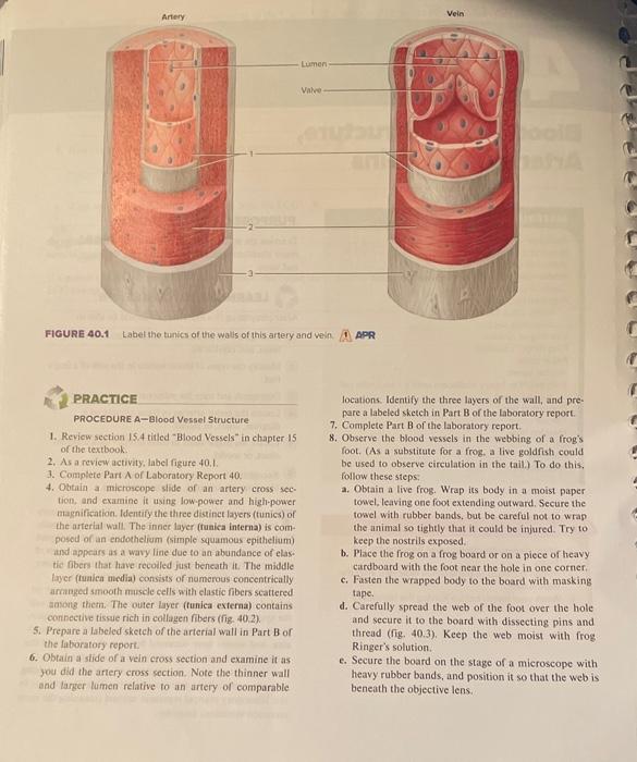 Solved FIGURE 40.1 Label the tunics of the walts of this | Chegg.com