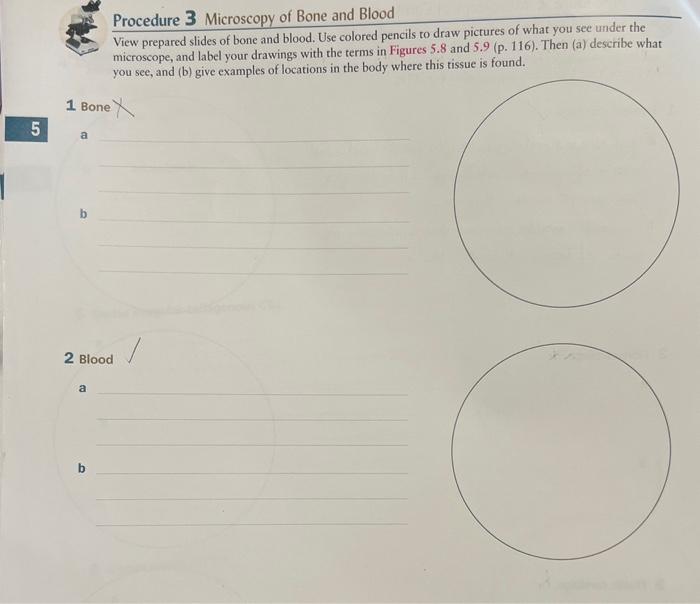 Solved Procedure 3 Microscopy of Bone and Blood View | Chegg.com