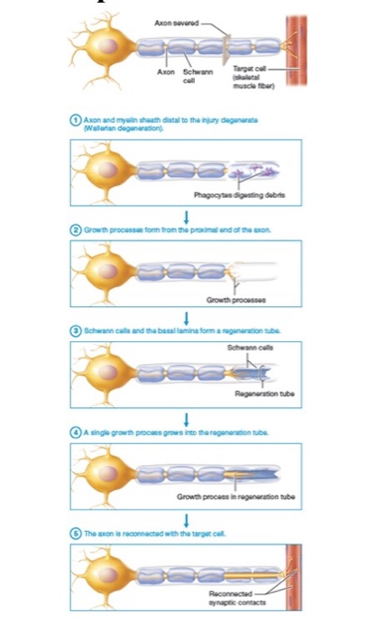 Solved Please describe the 5 steps of Peripheral Axon Repair | Chegg.com