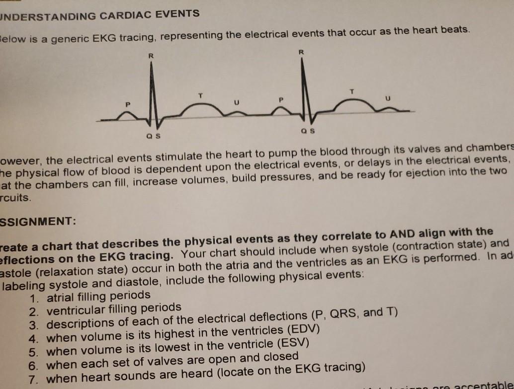 Solved UNDERSTANDING CARDIAC EVENTS Below is a generic EKG | Chegg.com