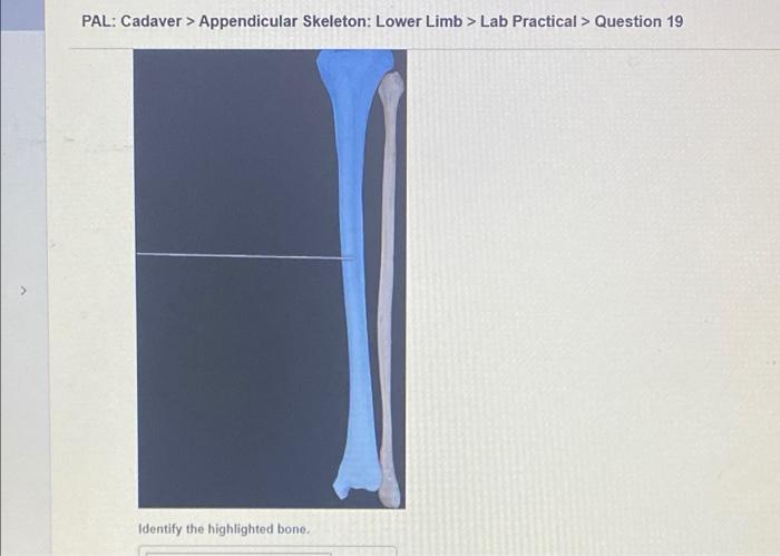 Solved PAL: Cadaver > Appendicular Skeleton: Pelvic Girdle > | Chegg.com