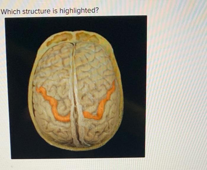 Solved Which structure is highlighted? central sulcus O | Chegg.com
