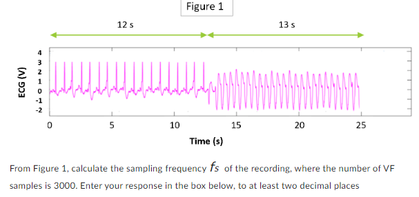 Solved Figure 1From Figure 1, ﻿calculate the sampling | Chegg.com