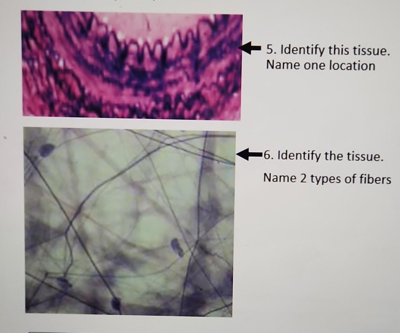 Solved 7. Identify this tissue. Give one location 8. | Chegg.com