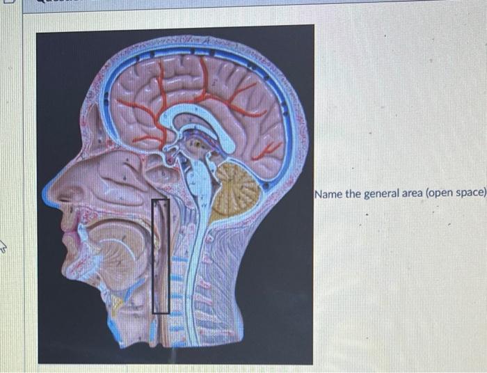 Solved Name the general area open space) | Chegg.com