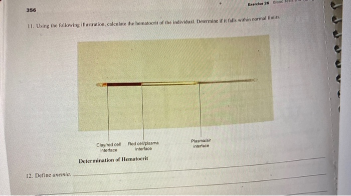 Solved Exercise 26 Blood 356 11. Using the following | Chegg.com