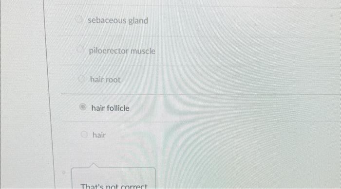 Solved Which structure is highlighted? sebaceous gland | Chegg.com