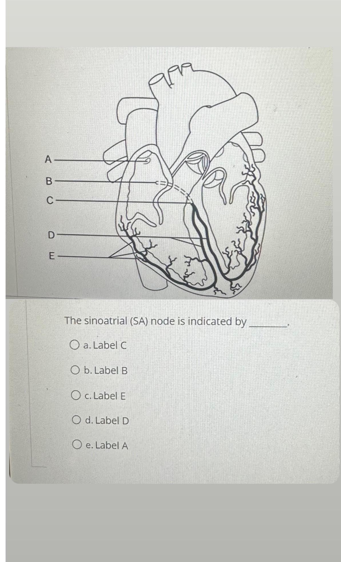Solved The sinoatrial (SA) ﻿node is indicated bya. ﻿Label | Chegg.com