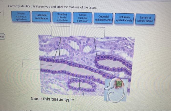 Solved Correctly identify this tissue type and label the | Chegg.com
