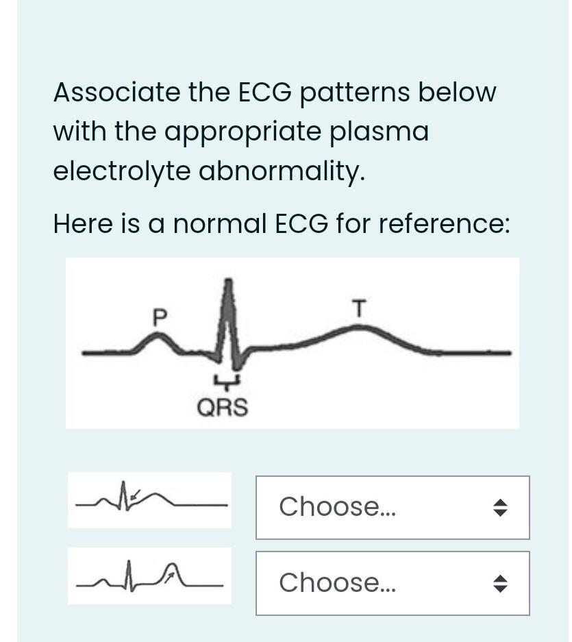 Solved plasma electrolyte abnormalities can alter electrical | Chegg.com