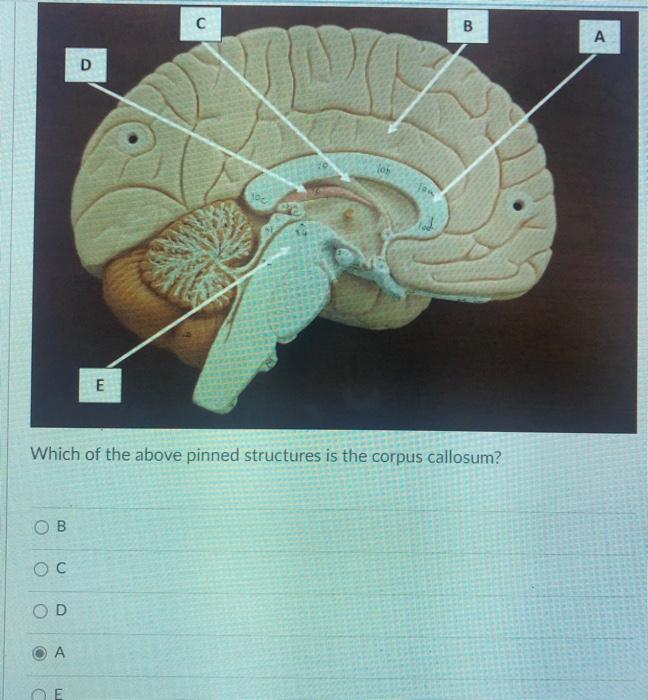 Solved Which of the above pinned structures is the corpus | Chegg.com