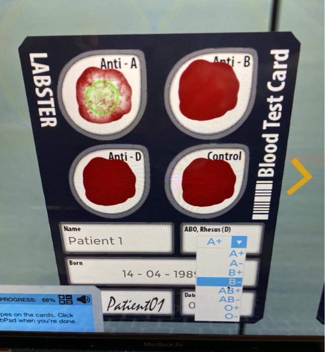 Solved Anti-A Anti-B LABSTER CHI Blood Test Card Anti-D | Chegg.com