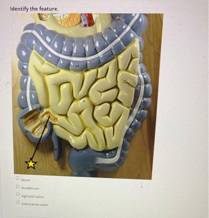 Solved Identify the feature. ileum O duodenum sigmoid colon | Chegg.com