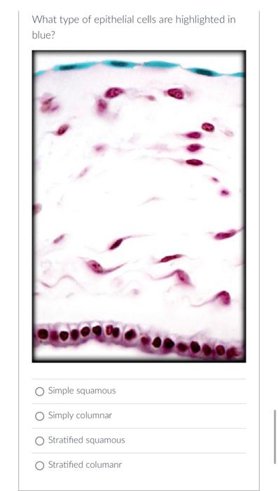 Solved What type of epithelial cells are highlighted in | Chegg.com