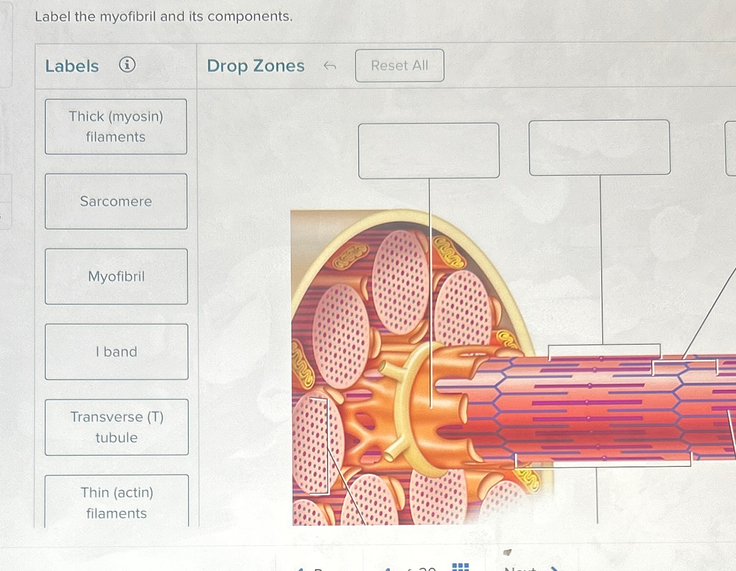 Solved Label the myofibril and its components. | Chegg.com Solved Label the myofibril and its components. | Chegg.com