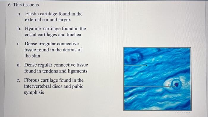 Solved 이 5. This tissue is a. Elastic cartilage found in the | Chegg.com
