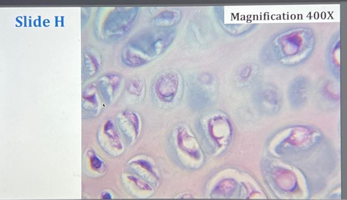 Solved Slide F Magnification 1000X Hint: this is not an | Chegg.com