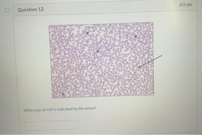 Solved 0.5 pts Question 12 What type of cell is indicated by | Chegg.com