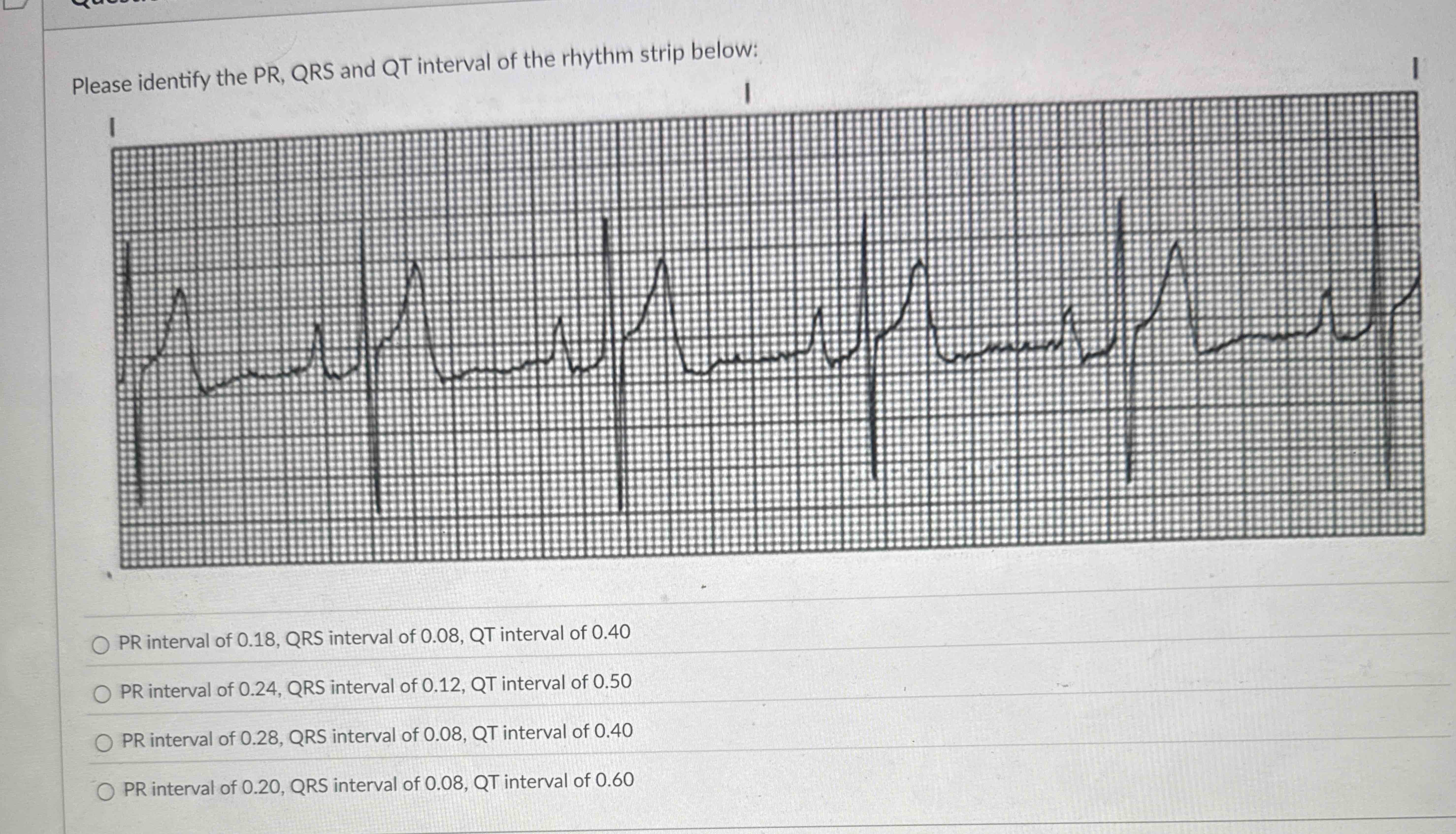 Solved Please identify the PR, ﻿QRS and QT interval of the | Chegg.com