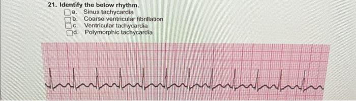 Solved 21. Identify the below rhythm. a. Sinus tachycardia | Chegg.com