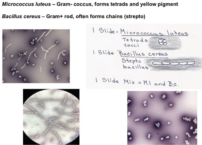 Solved EXPERIMENT 8-Negative Staining OBSERVATIONS Name: | Chegg.com