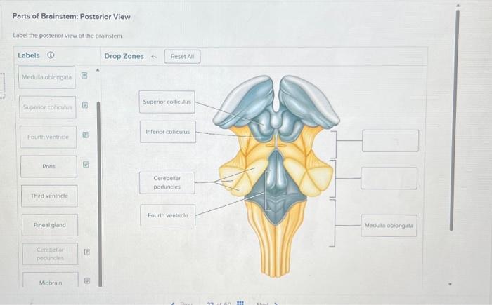 Solved **** Parts of Brainstem: Posterior View Label the | Chegg.com