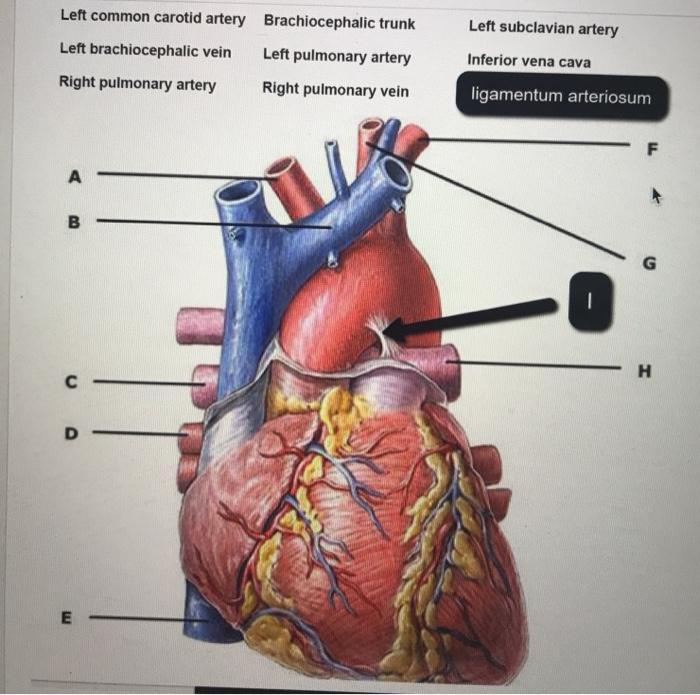 Solved Left common carotid artery Brachiocephalic trunk Left | Chegg.com