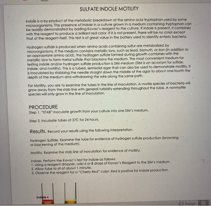Solved Sulfate Indole Motility (SIM) 1. What three results | Chegg.com
