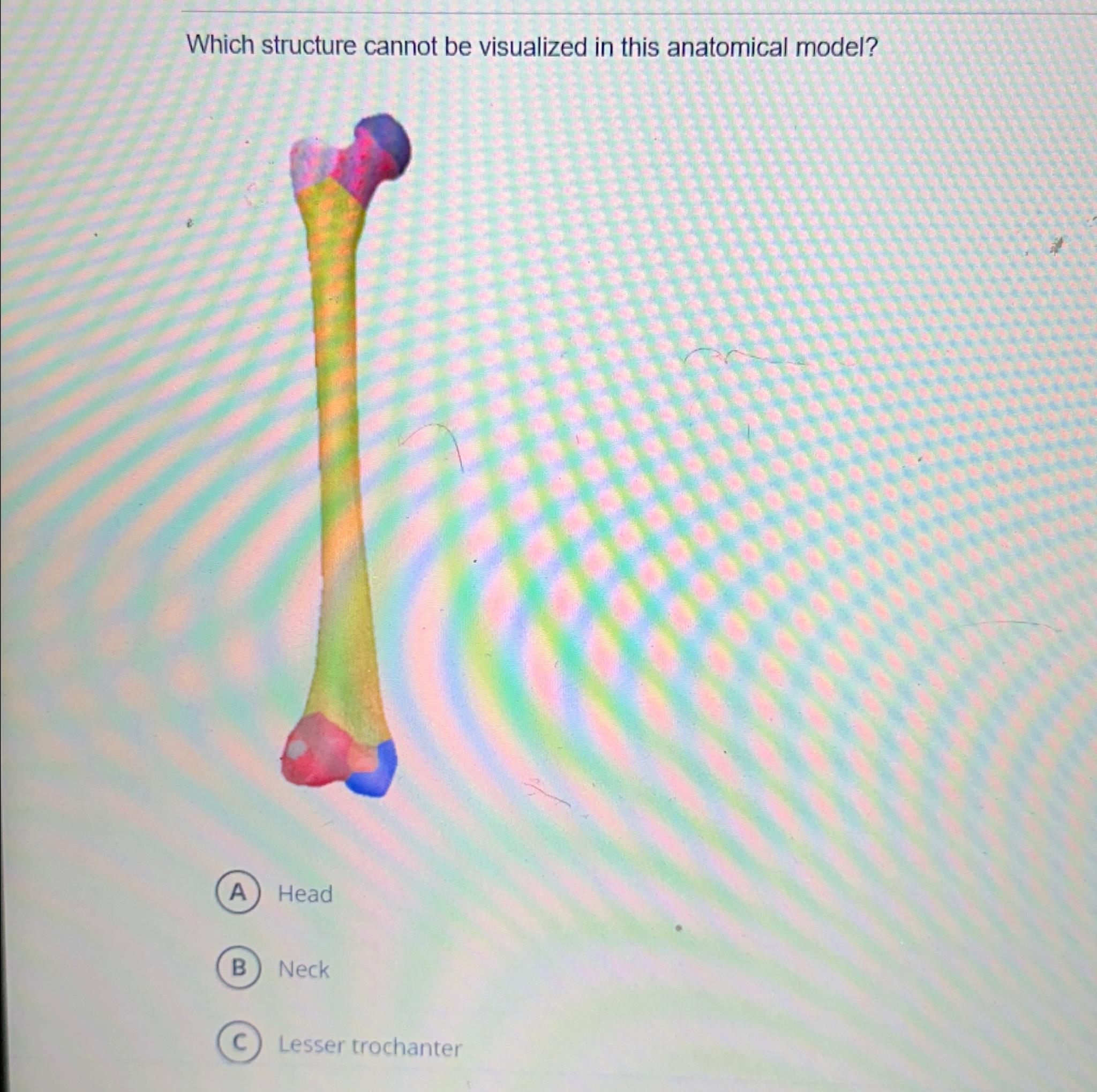 Solved Which structure cannot be visualized in this | Chegg.com