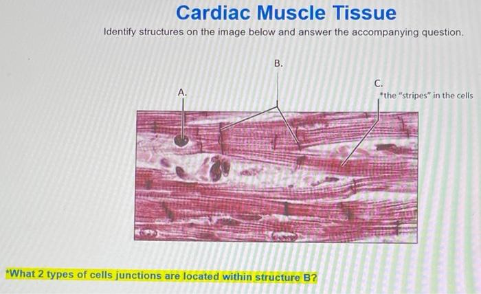 Solved Heart Rate Calculation Determine the duration of the | Chegg.com