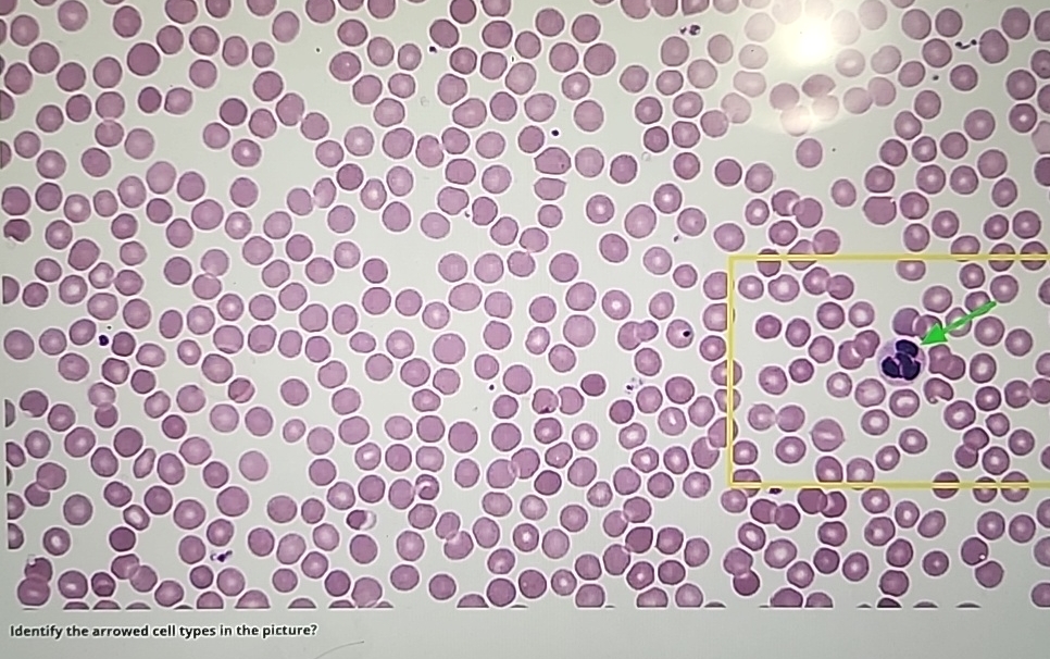 Identify the arrowed cell types in the picture?ROO | Chegg.com